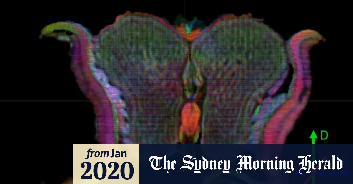 Video: Watch: a detailed map of squid brains