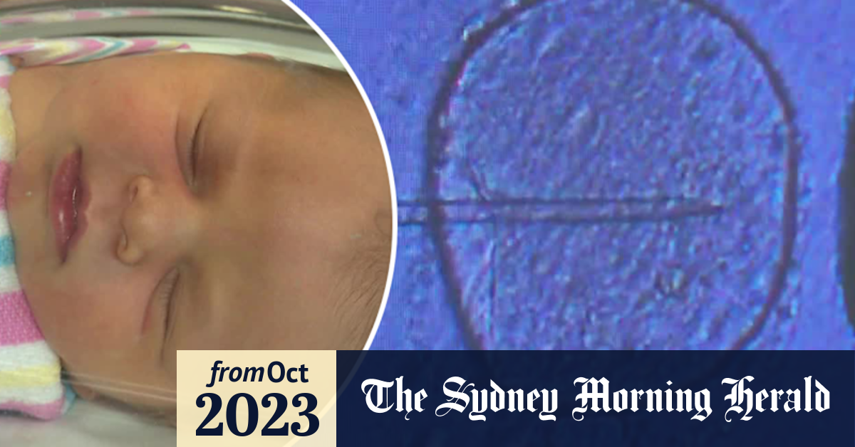 Video: Baby born using pioneering IVF technique