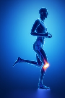 Osteoarthritis of the knee sufferers should think again about surgery
