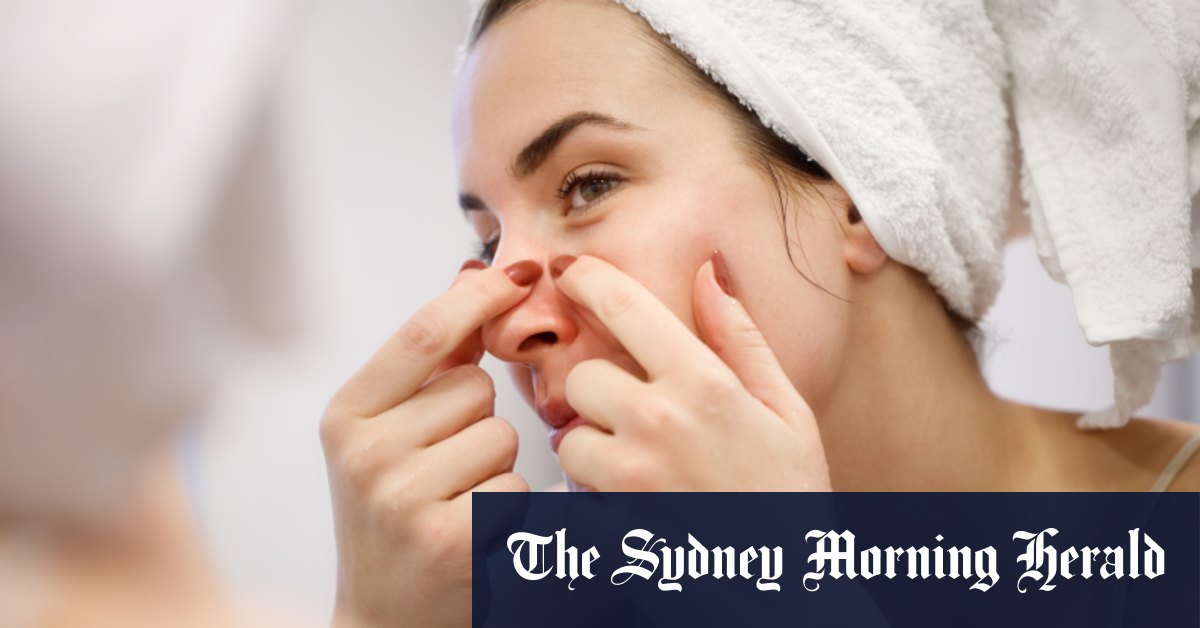 Tempted To Squeeze Your Blackheads Do This Instead