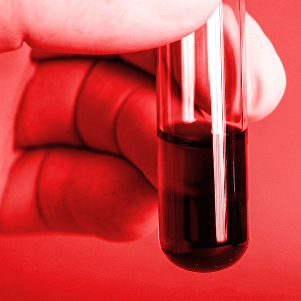 Biological age tests: How accurate are TruAge and GrimAge DNA ...