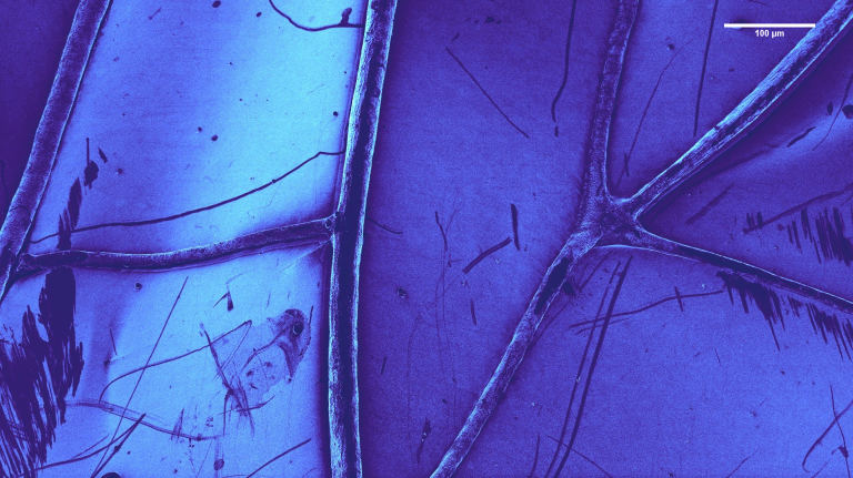 How dragonfly wings could help build bacteria-busting surgical tools