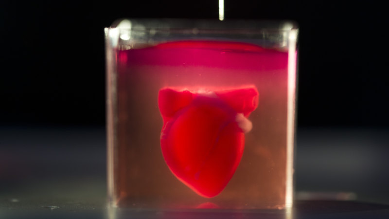 3D heart with chambers, blood vessels printed using patient's own cells