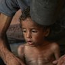 Yazan Abu Ful, a two-year-old malnourished child, sits with his father in the Shati refugee camp in Gaza City.