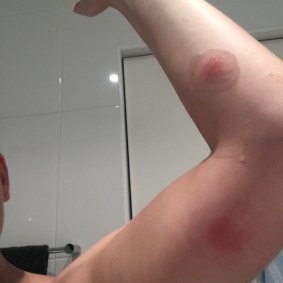 white spider bite me