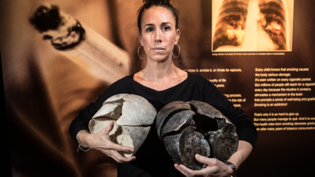 This exhibit will make you ditch junk food, and the darts, for life