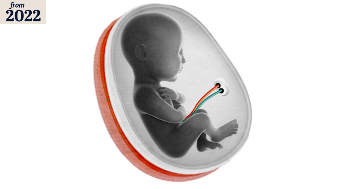 IVF breakthroughs: How three-parent babies, uterus transplants are ...