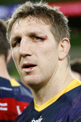 Storm forward Ryan Hoffman refuses to give up on NRL return