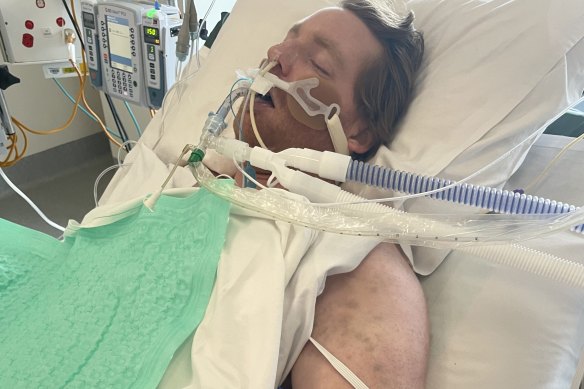 Luke Briggs: Coroner to investigate after builder dies from injuries ...