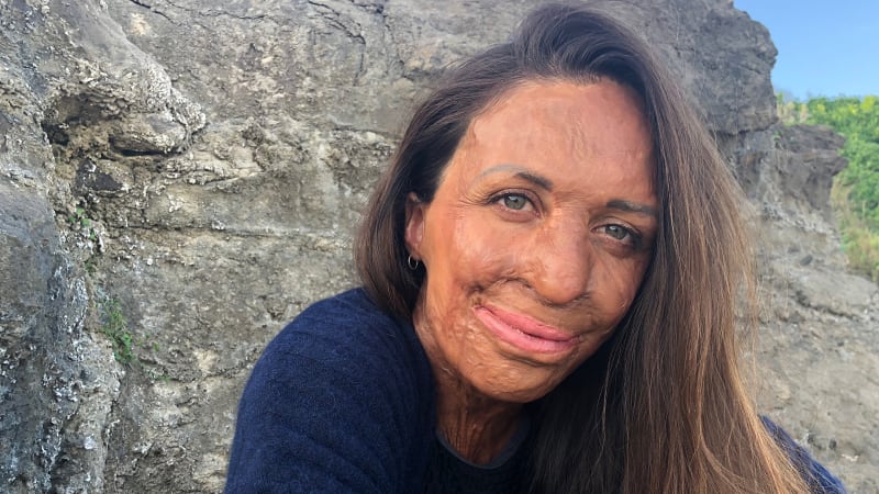 Turia Pitt: "We need to teach our children about resilience"