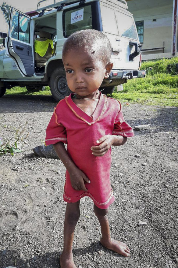 ‘Eating only leaves’: Dying of hunger in Ethiopia’s blockaded Tigray