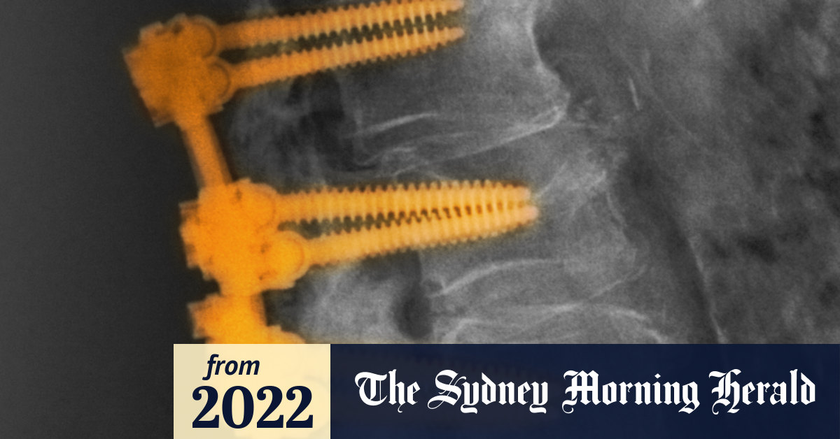 Medicare fraud: Expensive spine fusion surgery billed inappropriately ...
