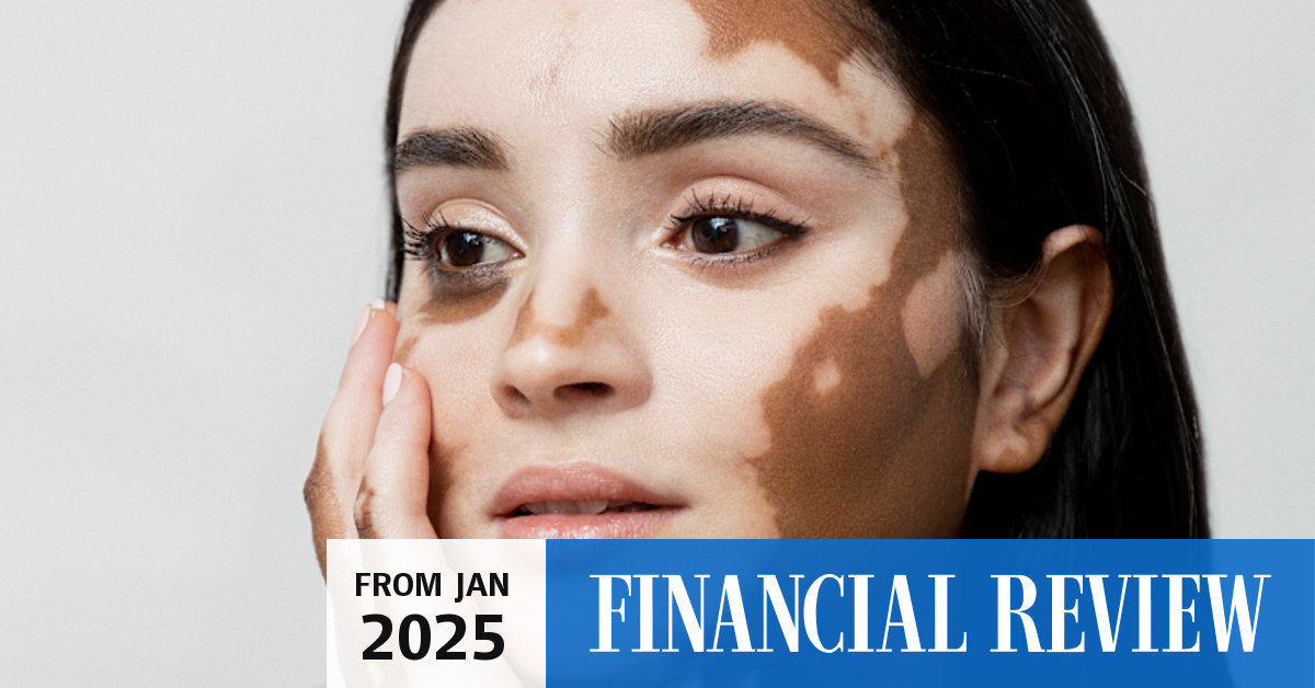 AVH ASX: Fallen angel Avita Medical nosedives 18pc on revenue miss