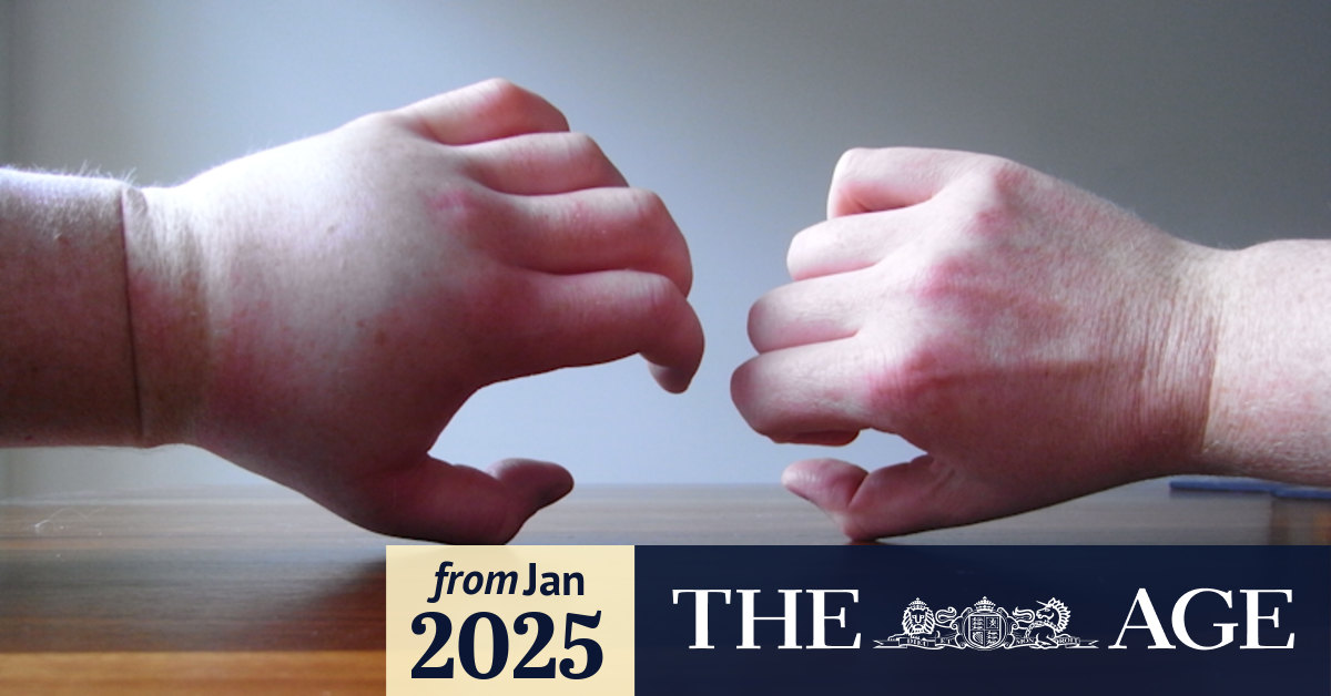 Andembry: How hereditary angioedema sufferers have new hope with ...