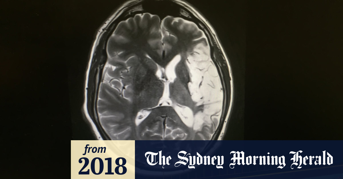 The day Anthony Coates forgot his name