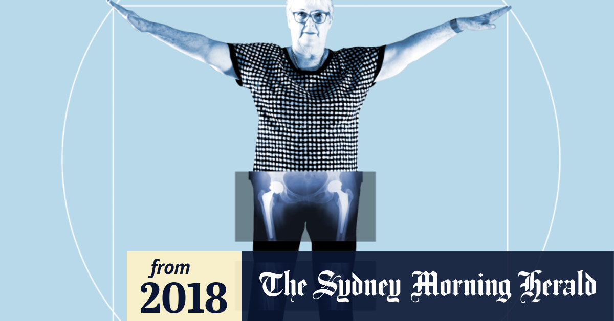 'They want the quick fix': Bionic Baby Boomers upend health system