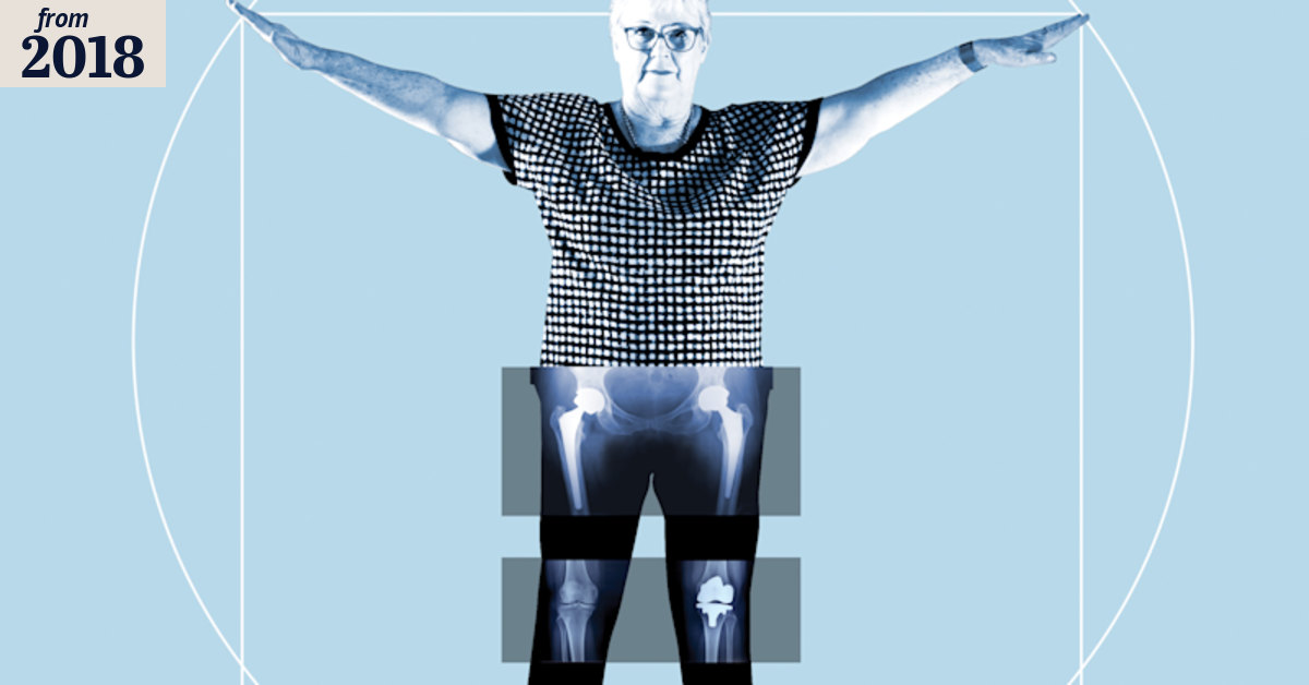 'They want the quick fix': Bionic Baby Boomers upend health system