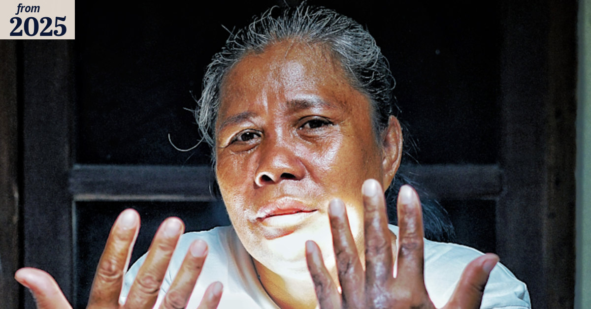 Indonesia politics: 2005 Bali Bombing patients caught up in government ...