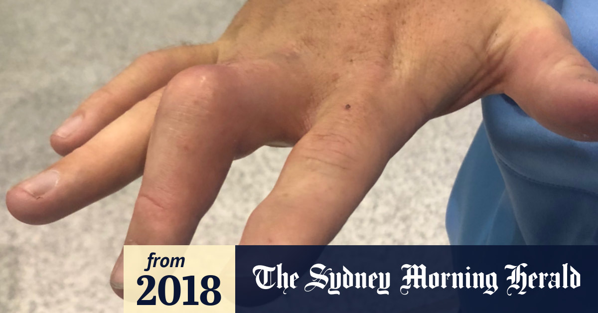 Klemmer knuckles down despite Crichton pointing him towards the chop