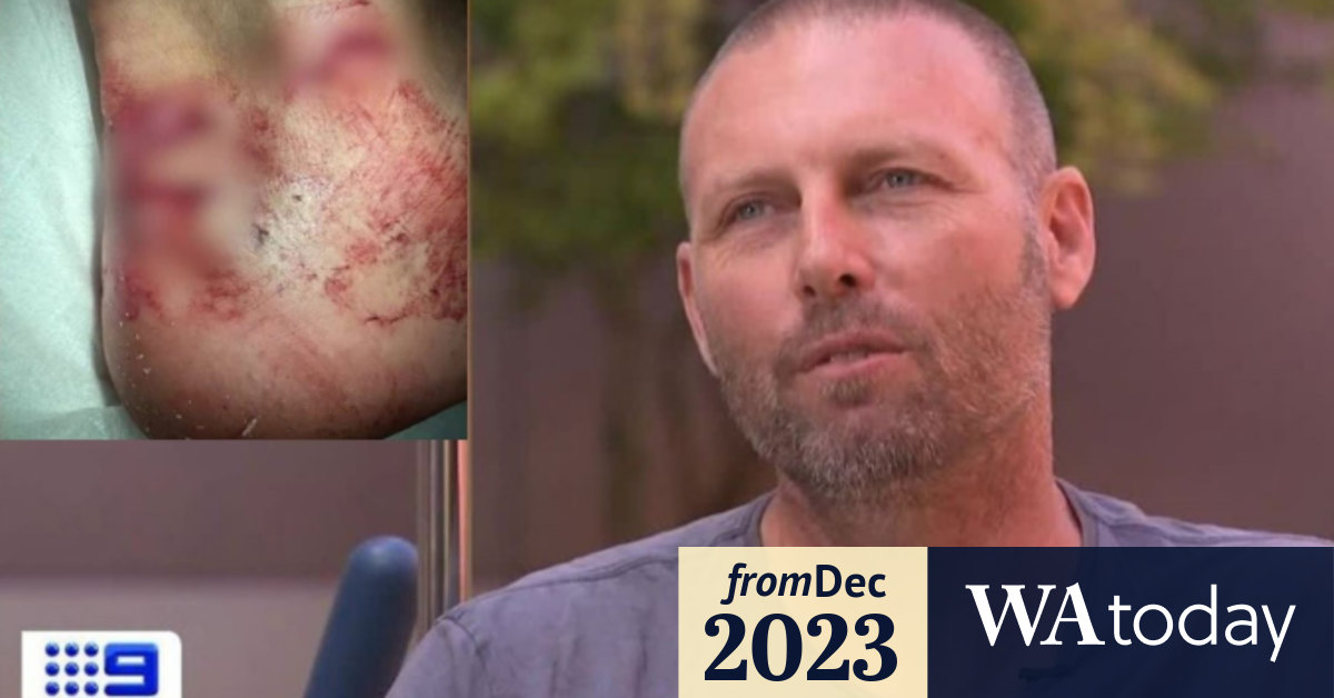 Perth father describes narrow escape after being bitten by shark