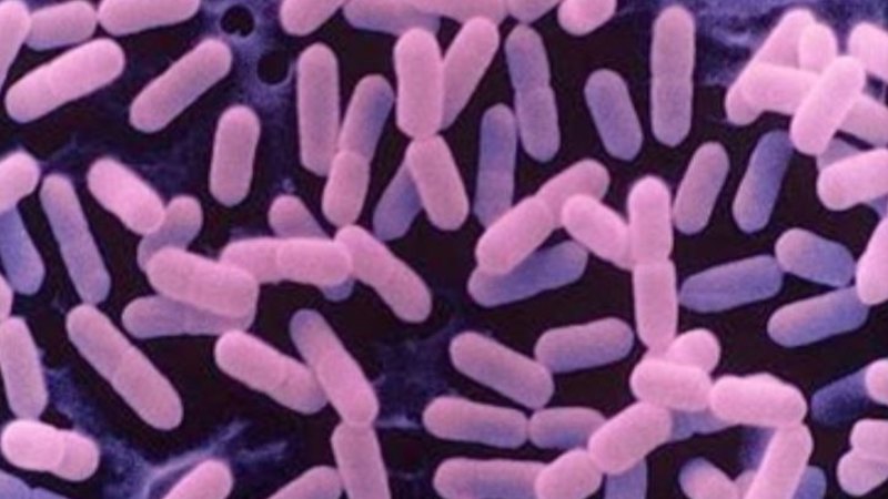 Thousands are at risk of listeria infection: What is listeriosis?