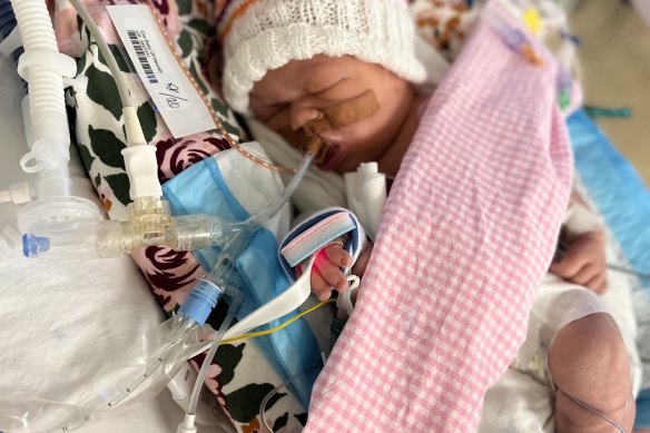 ‘It was a bleak time’: Baby born with organs outside body defies the odds