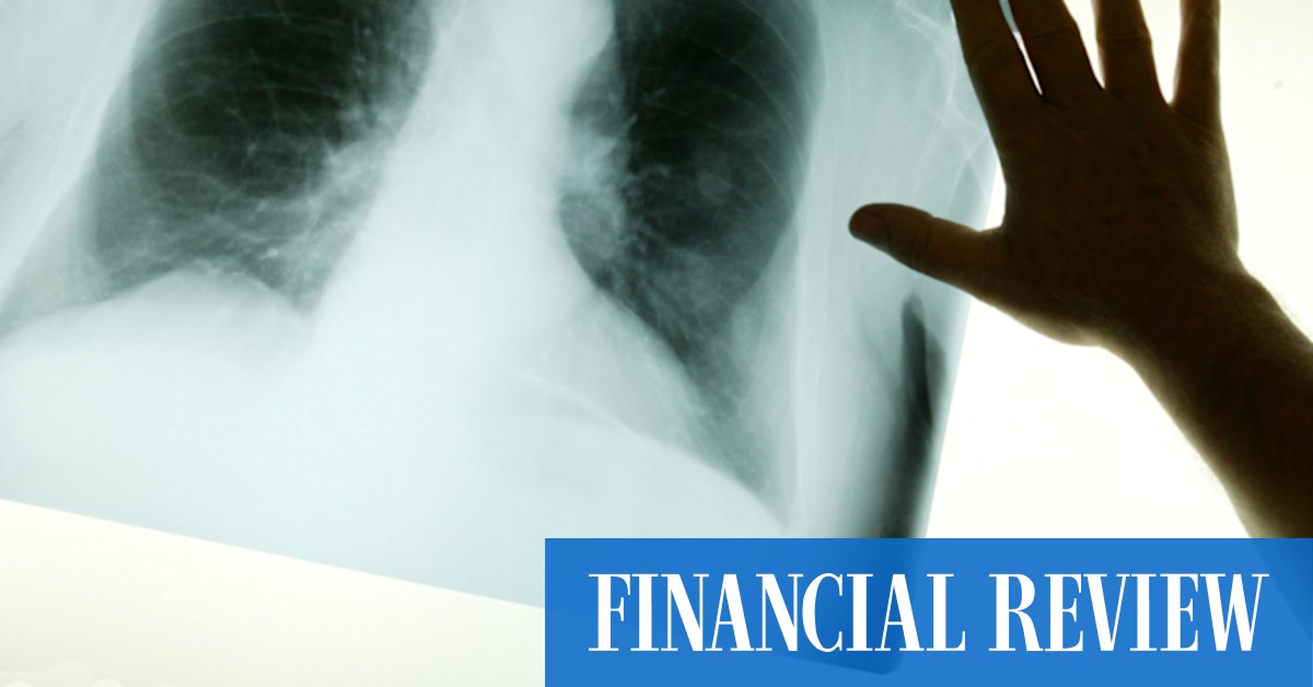 PRP Diagnostic Imaging acquires Alto Imaging to expand NSW footprint