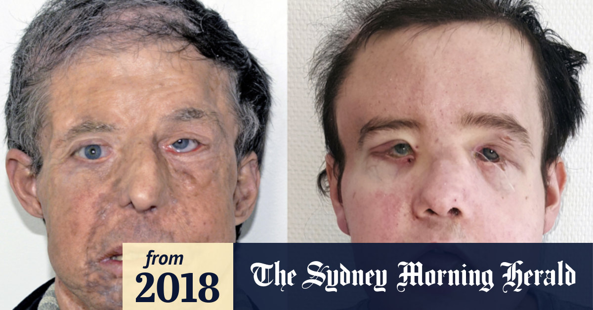 French man with 'three faces' accepts his new identity - again