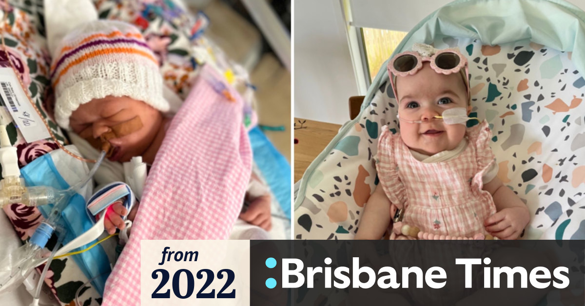 ‘It was a bleak time’: Baby born with organs outside body defies the odds