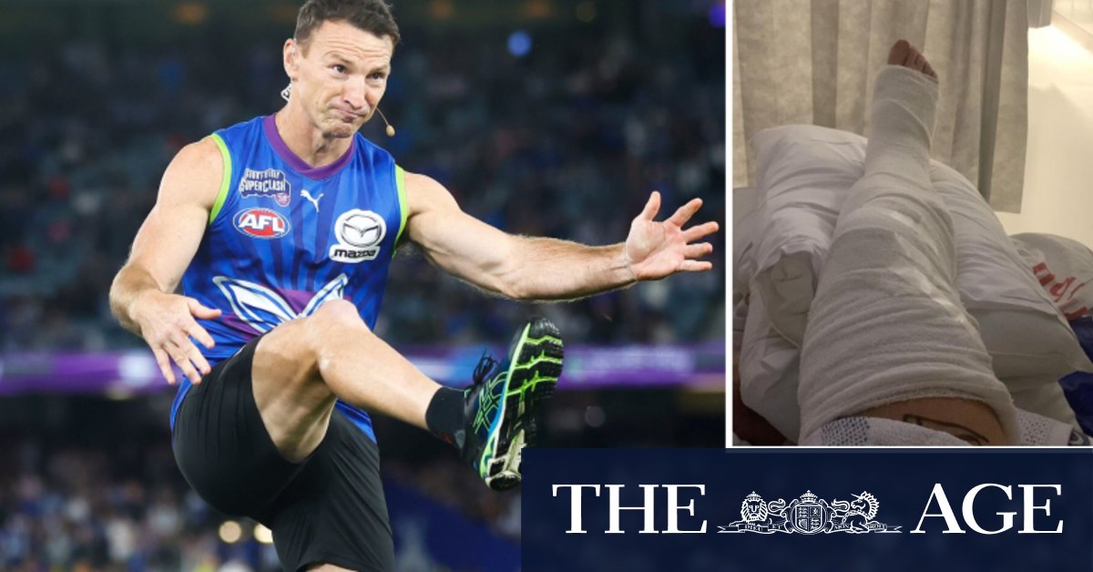 AFL 2023: Brent Harvey suffers broken leg at local footy game, waits ...
