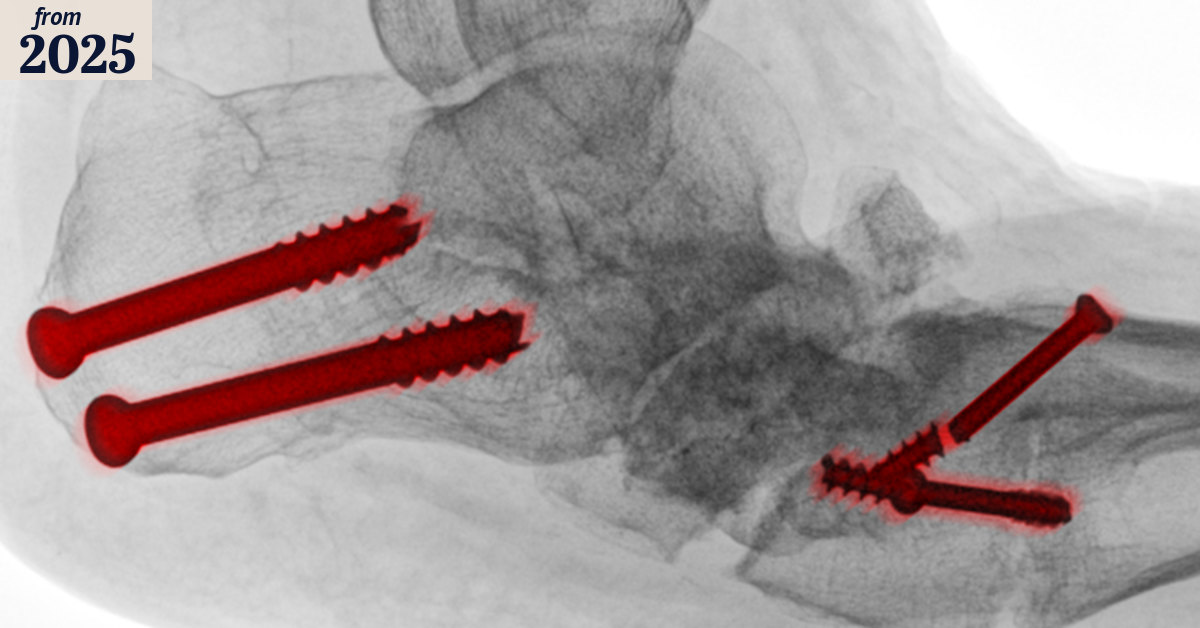Podiatric surgeons to get new title of surgical podiatrists after ...