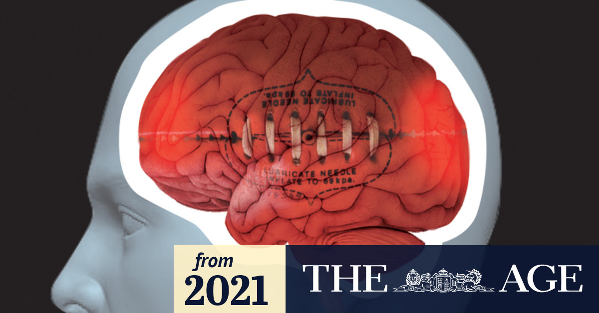 Concussion and CTE: AFL brain disease cases ‘tip of the iceberg’, says ...