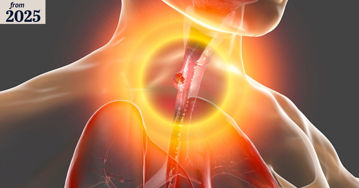 Medical big guns help Proteomics rev up Aussie cancer test rollout