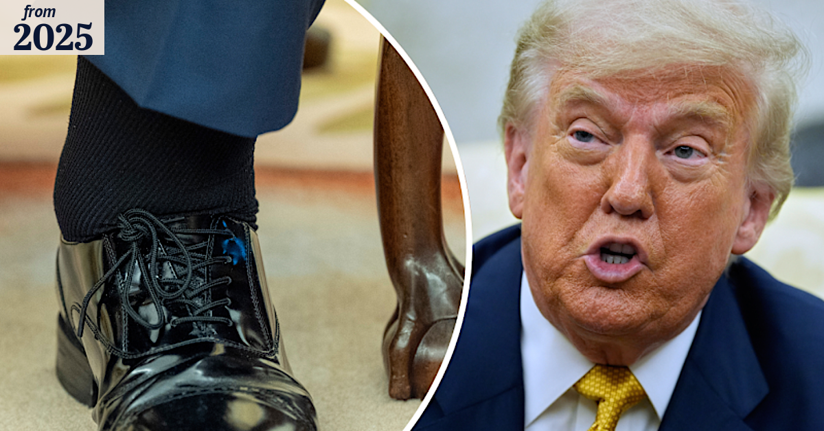 Donald Trump health: What Chronic venous insufficiency diagnosis means ...