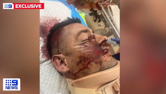 NSW man Andreas Lehr allegedly king hit outside RAC Arena in Perth ...