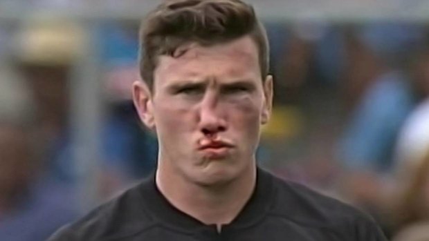 'His nose doesn't look very flash': Kiwi sevens player continues on ...