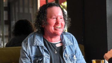 I didn't think disability could be great: Lunch with Carly Findlay