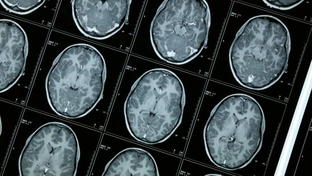 ReAnima Project: first step in bringing humans 'back from the dead ...