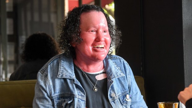 I didn't think disability could be great: Lunch with Carly Findlay