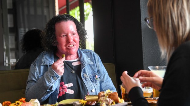 I didn't think disability could be great: Lunch with Carly Findlay