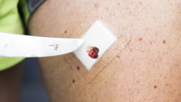 'I knew I was in trouble': Incredible story of survival after hunting ...