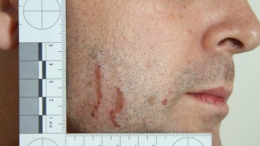 Baden-Clay: Scratches the most damning evidence, says prosecution