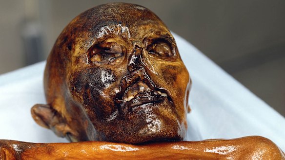 Bacterium in Otzi the Iceman's stomach provides human migration clues