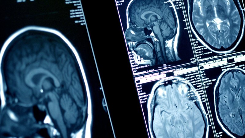 Dr Karl's science conundrums: How radioactive is the human body?