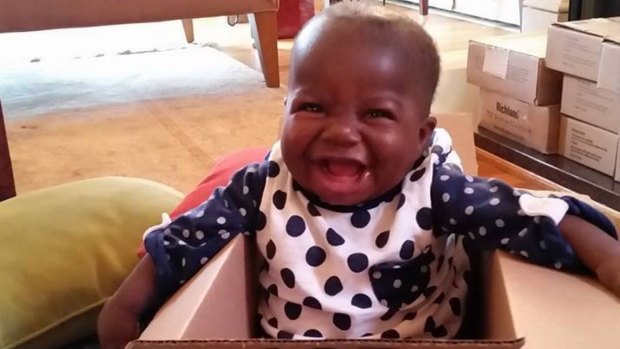 Ten-month-old baby Dominique has rare parasitic twin surgically removed ...