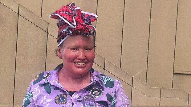 Carly Findlay sees kindness and opportunity beyond the virus