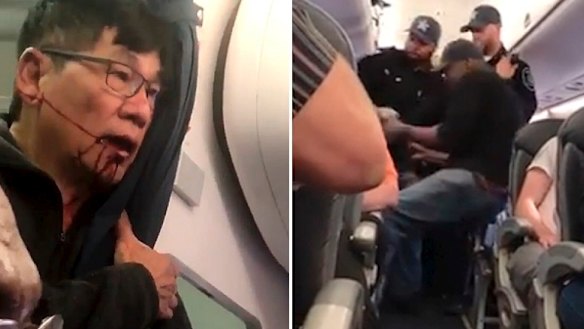 Doctor dragged screaming from United Airlines flight breaks silence