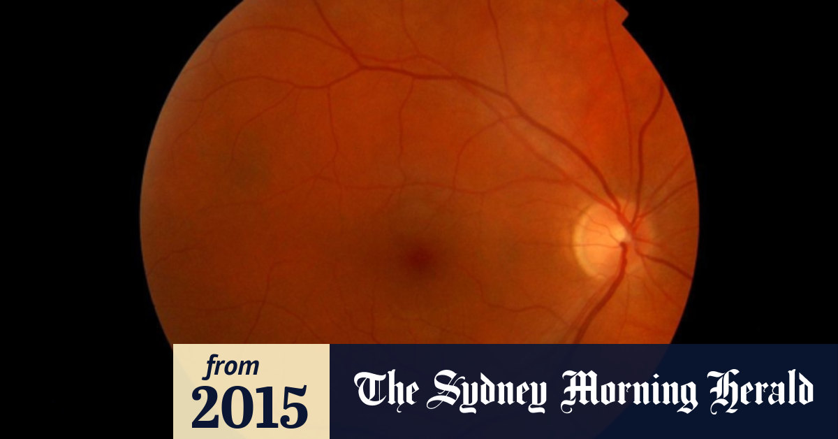 Look, your eyes are wired backwards: here's why