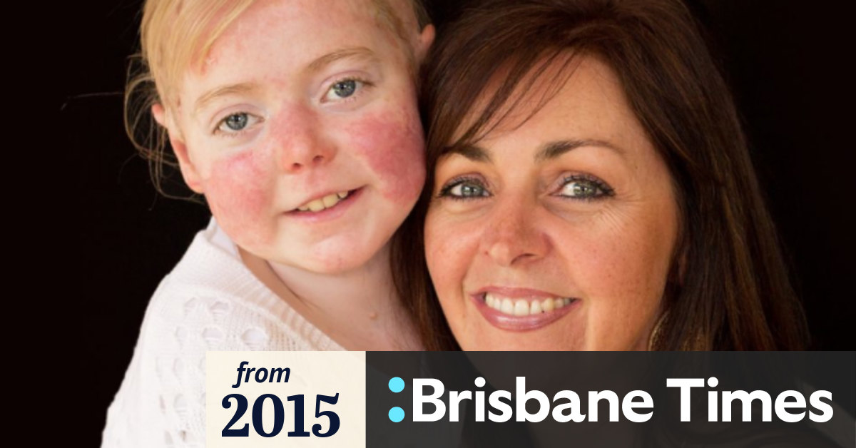 Epidermolysis Bullosa or life as a butterfly child