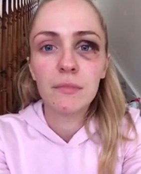 Fitness blogger Emma Murphy shares shocking video with Facebook followers